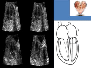 Cardiac biometry | PPT