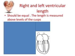 Cardiac biometry | PPT