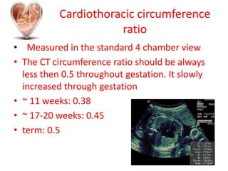 Cardiac biometry | PPT
