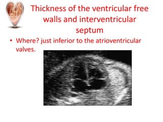 Cardiac biometry | PPT