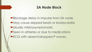 Cardiac block, B.S.Nursing, CTVS Nursing | PPT