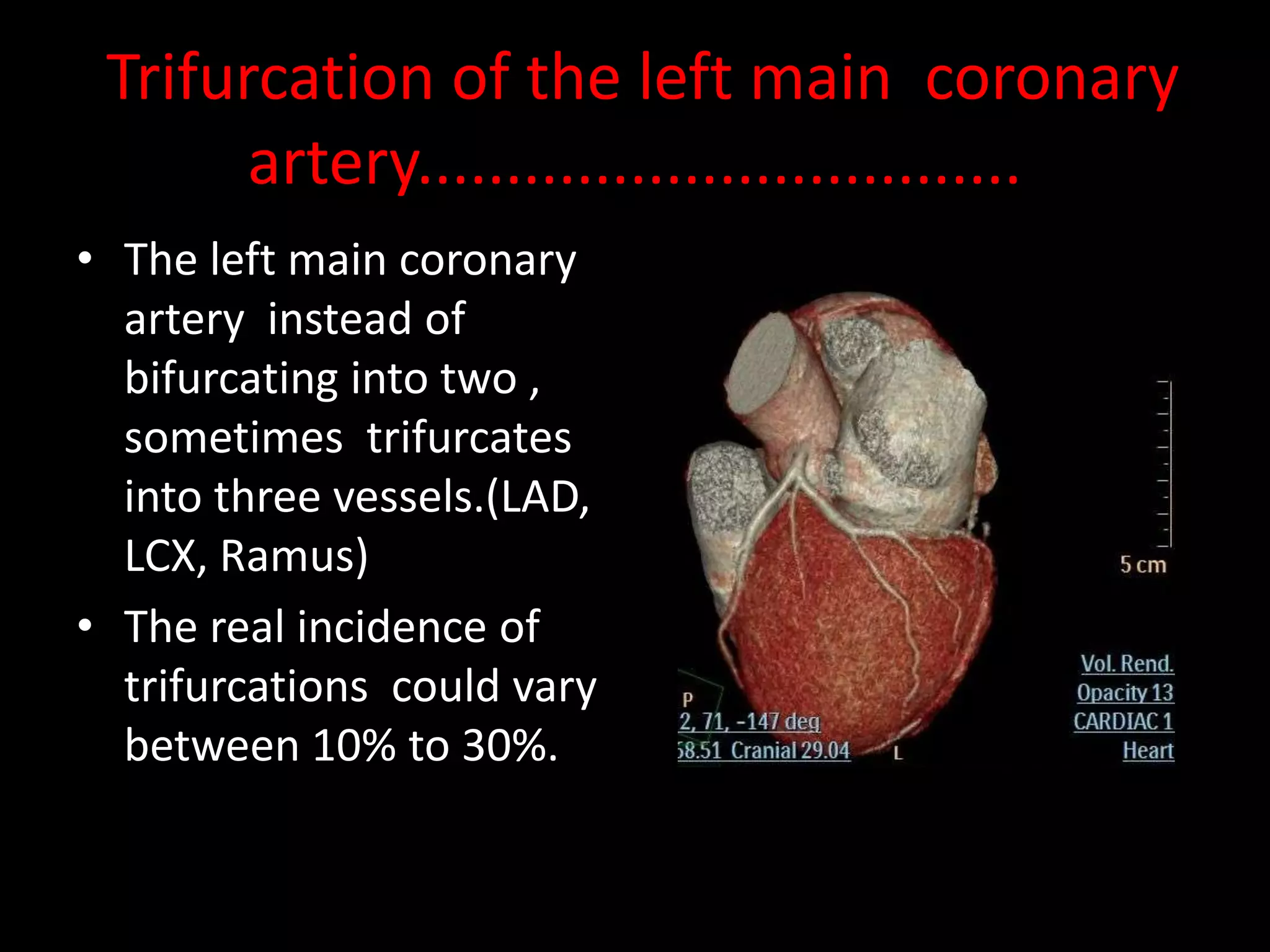 Cardiac case series ramus intermedius | PPTX