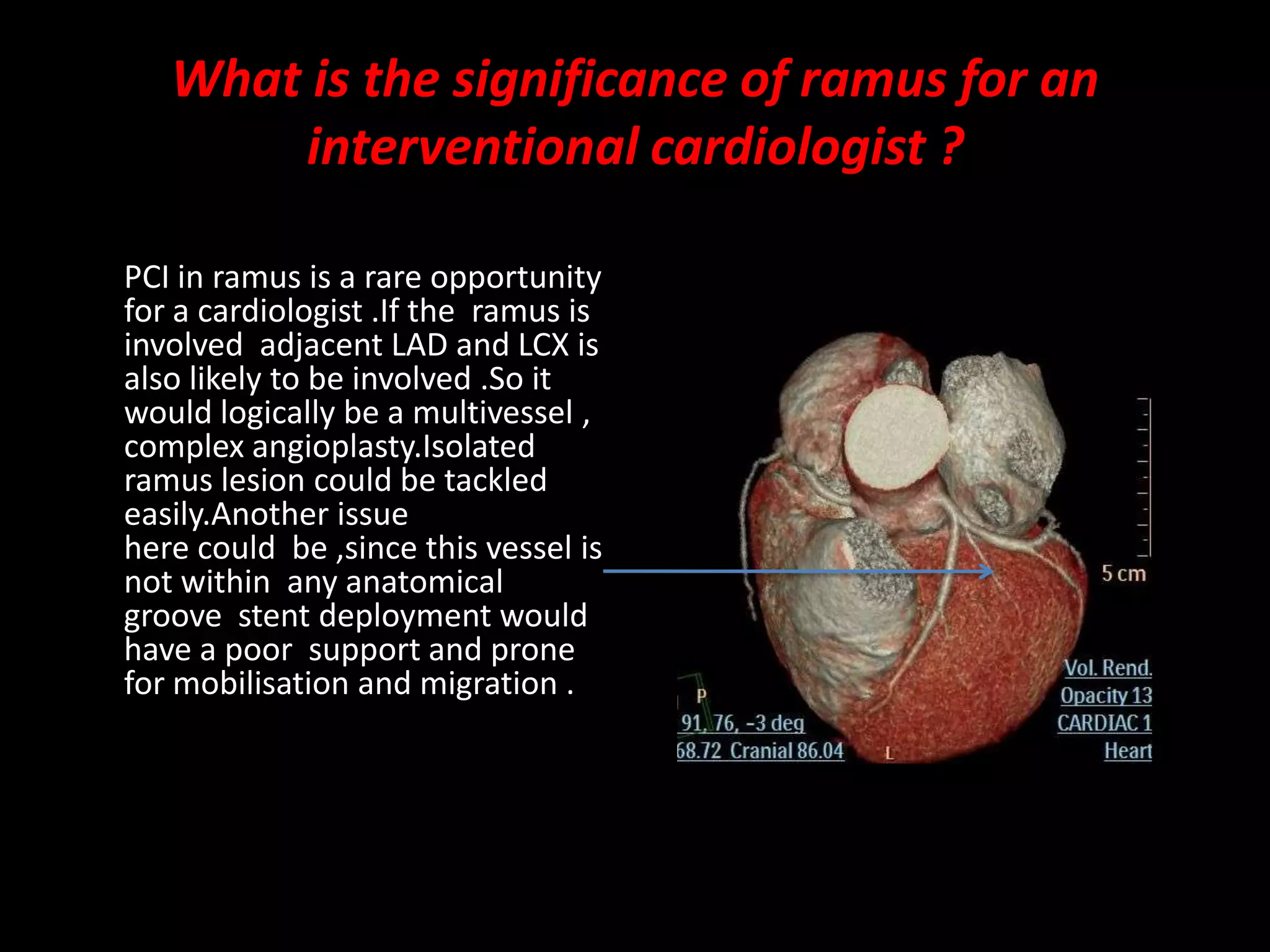 Cardiac case series ramus intermedius | PPTX