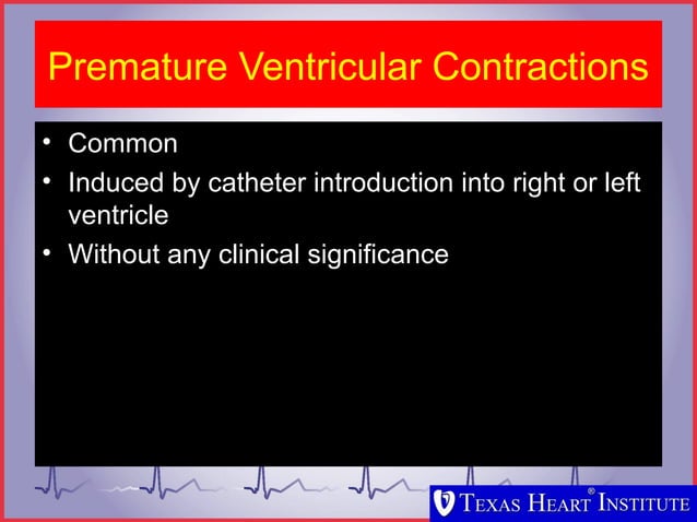 Cardiac cath complications | PPT