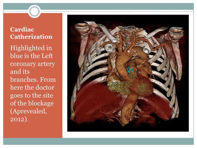Cardiac Catherization Ip 2 | PPT