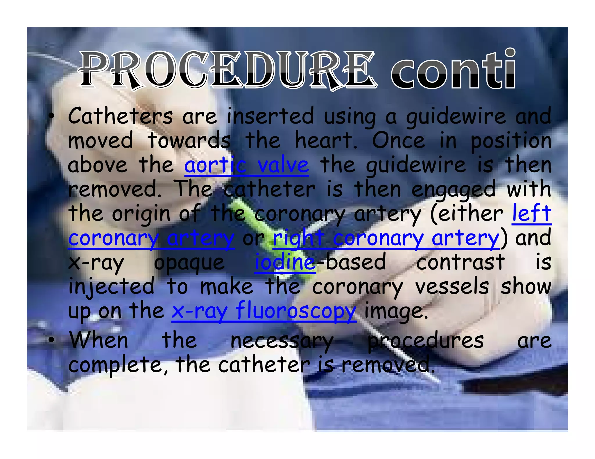 CARDIAC CATHERTERIZATION ...pdf