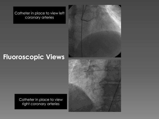 cardiaccatheterization-121024192733-phpapp01.pdf