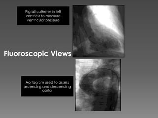 cardiaccatheterization-121024192733-phpapp01.pdf