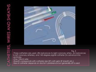 Cardiac catheterization | PPTX