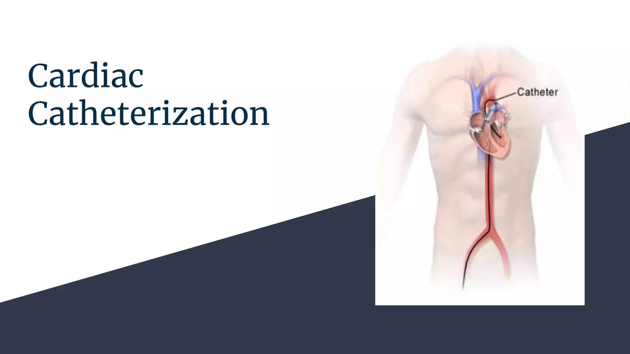 Cardiac catheterization | PPTX