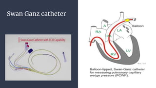 Cardiac catheterization | PPTX