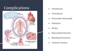 Cardiac catheterization | PPTX
