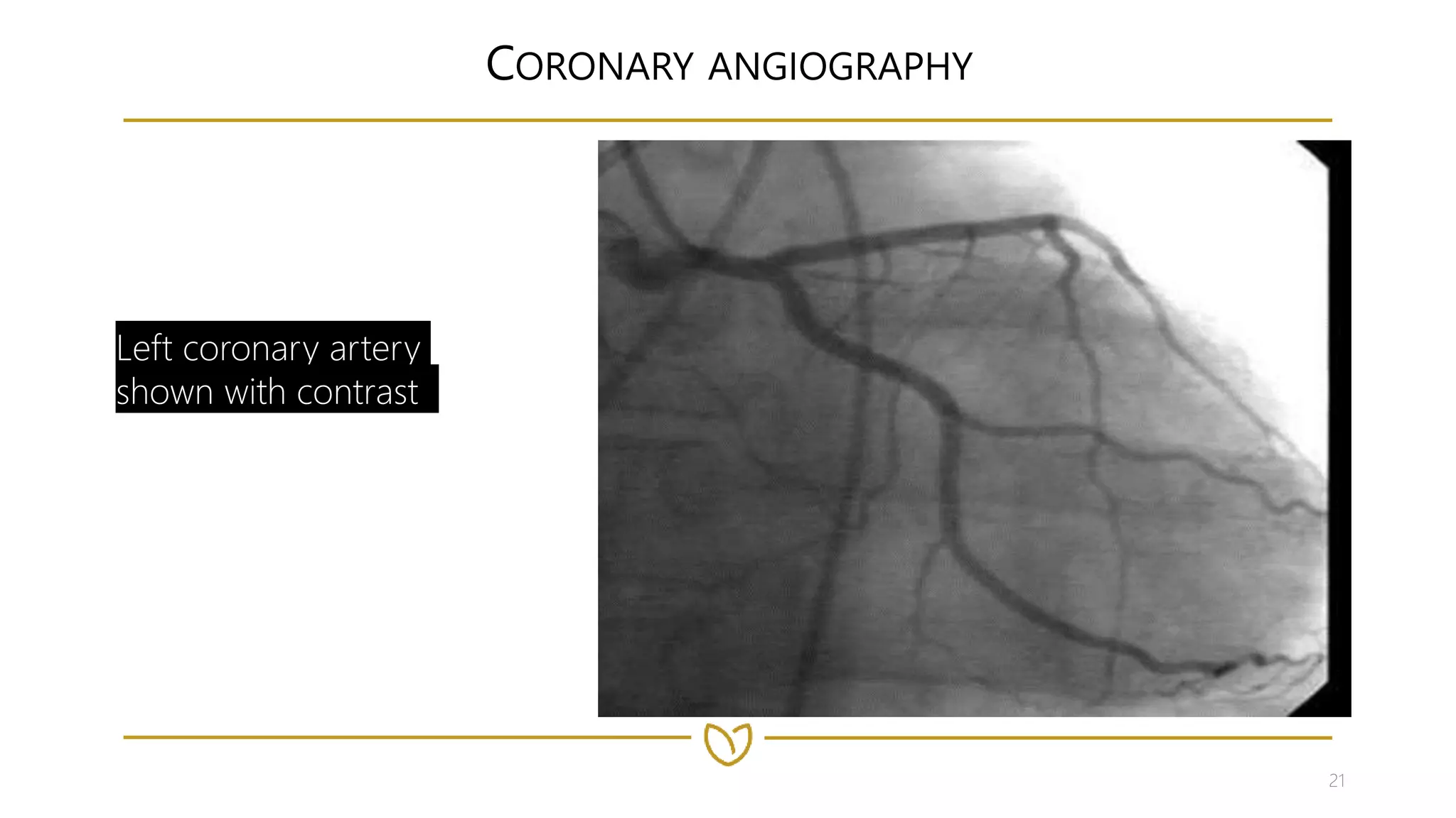 CARDIAC CATHETERIZATION.pptx