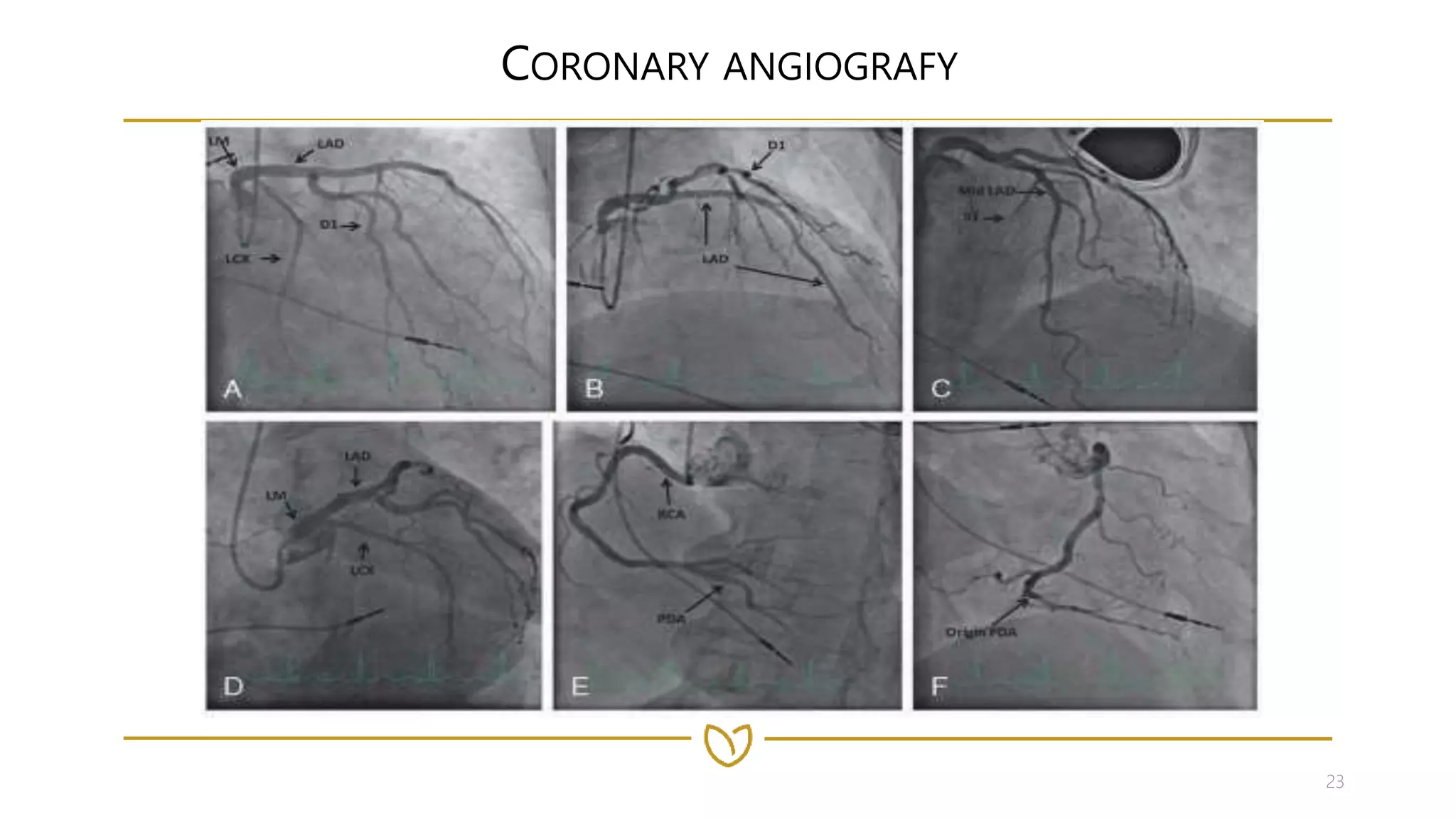 CARDIAC CATHETERIZATION.pptx