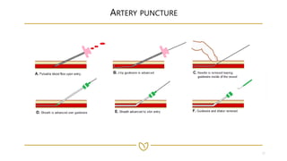 CARDIAC CATHETERIZATION.pptx