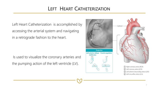 CARDIAC CATHETERIZATION.pptx | Heart and Cardiovascular Diseases | Diseases and Conditions