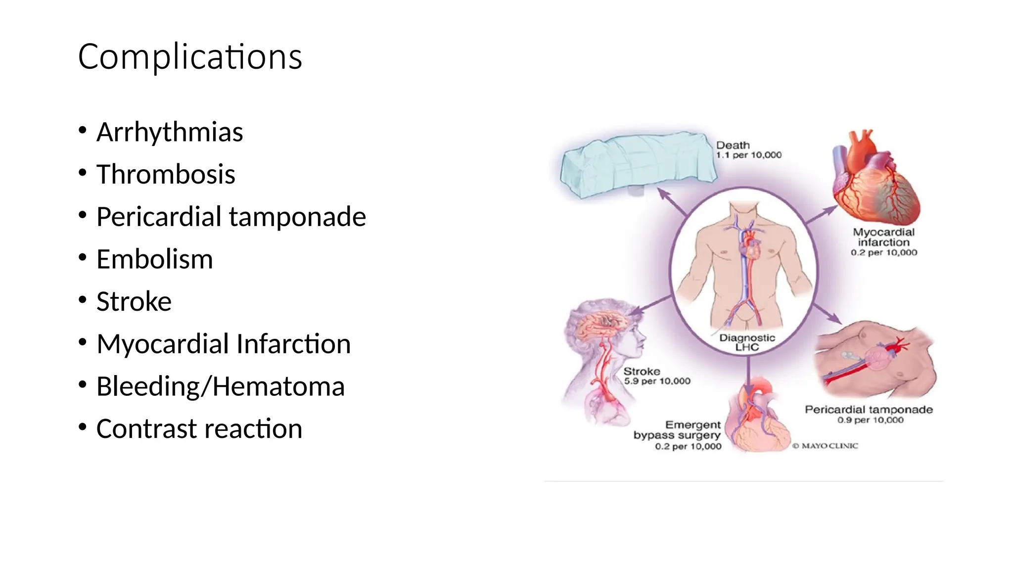 Cardiac Catheterization eeeeeeeeeeeeeeee | PPTX