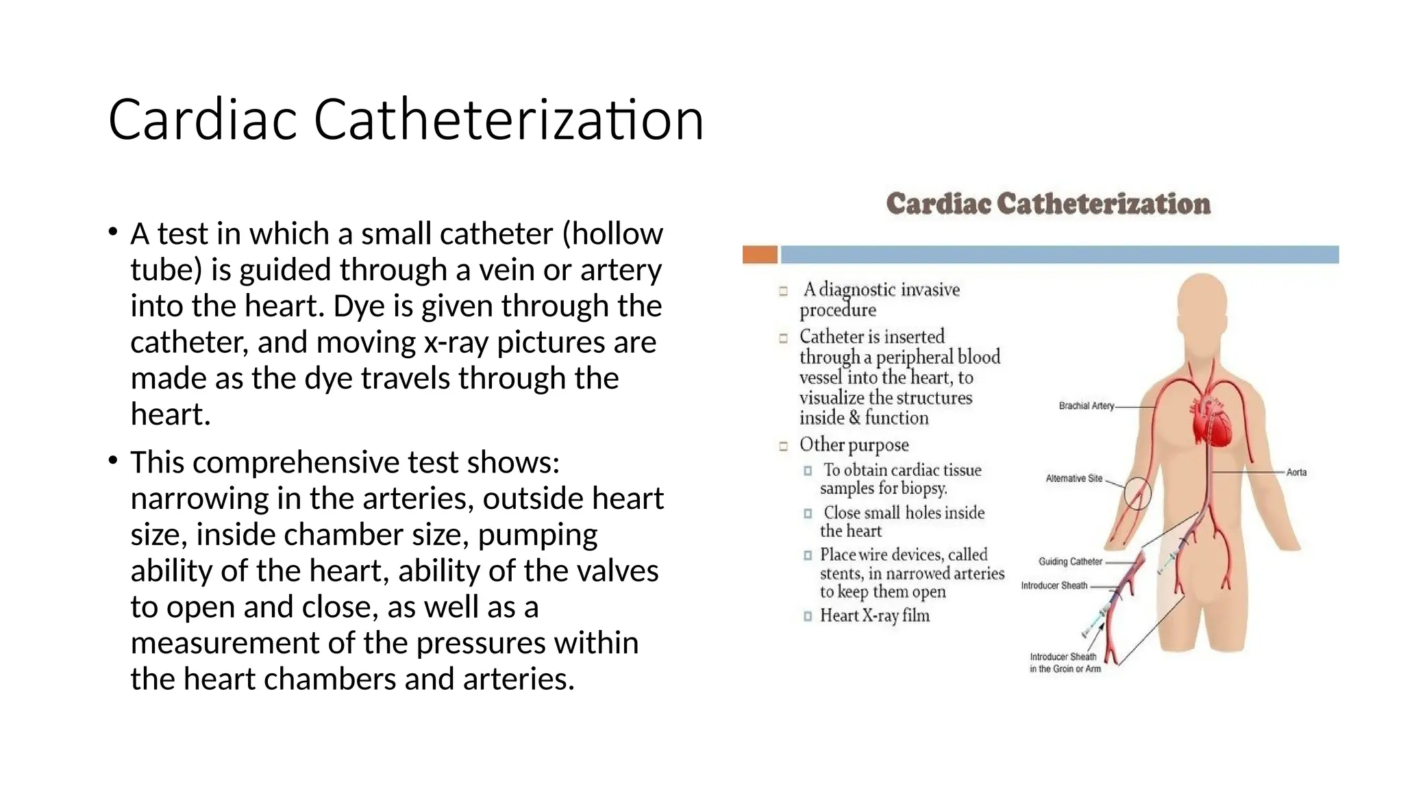 Cardiac Catheterization eeeeeeeeeeeeeeee | PPTX