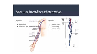 Cardiac Catheterization eeeeeeeeeeeeeeee | PPT