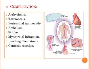 cardiac catheterizatio n 2.pdf