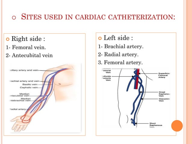 cardiac catheterizatio n 2.pdf