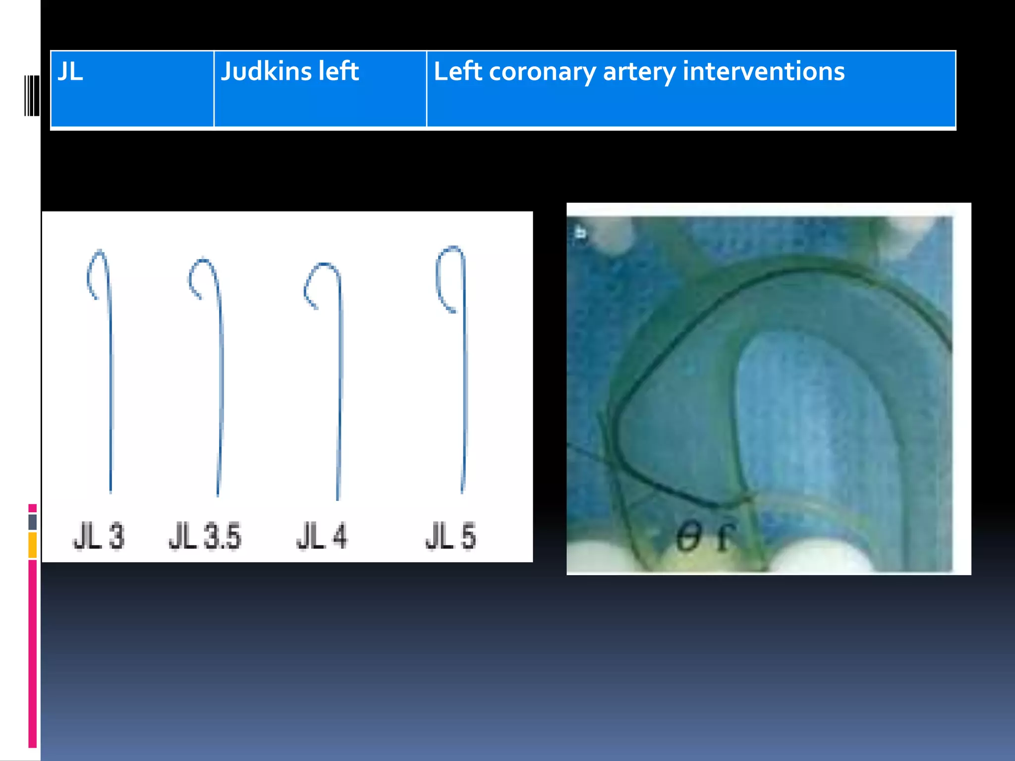 Cardiac catheterization at a glance (including instruments, view, dye ...
