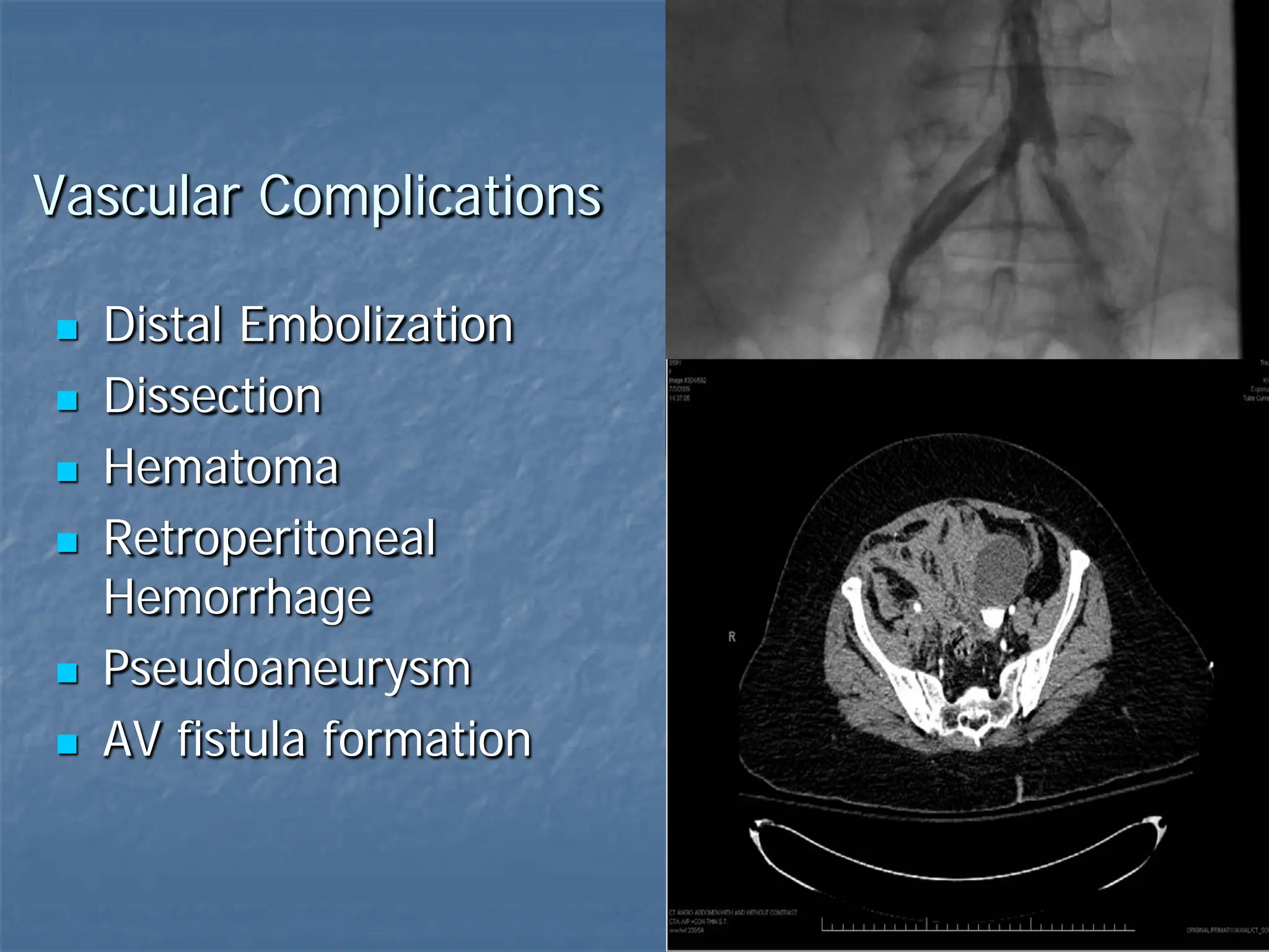 Cardiac Cath Lab Basics ( PDFDrive ).pdf