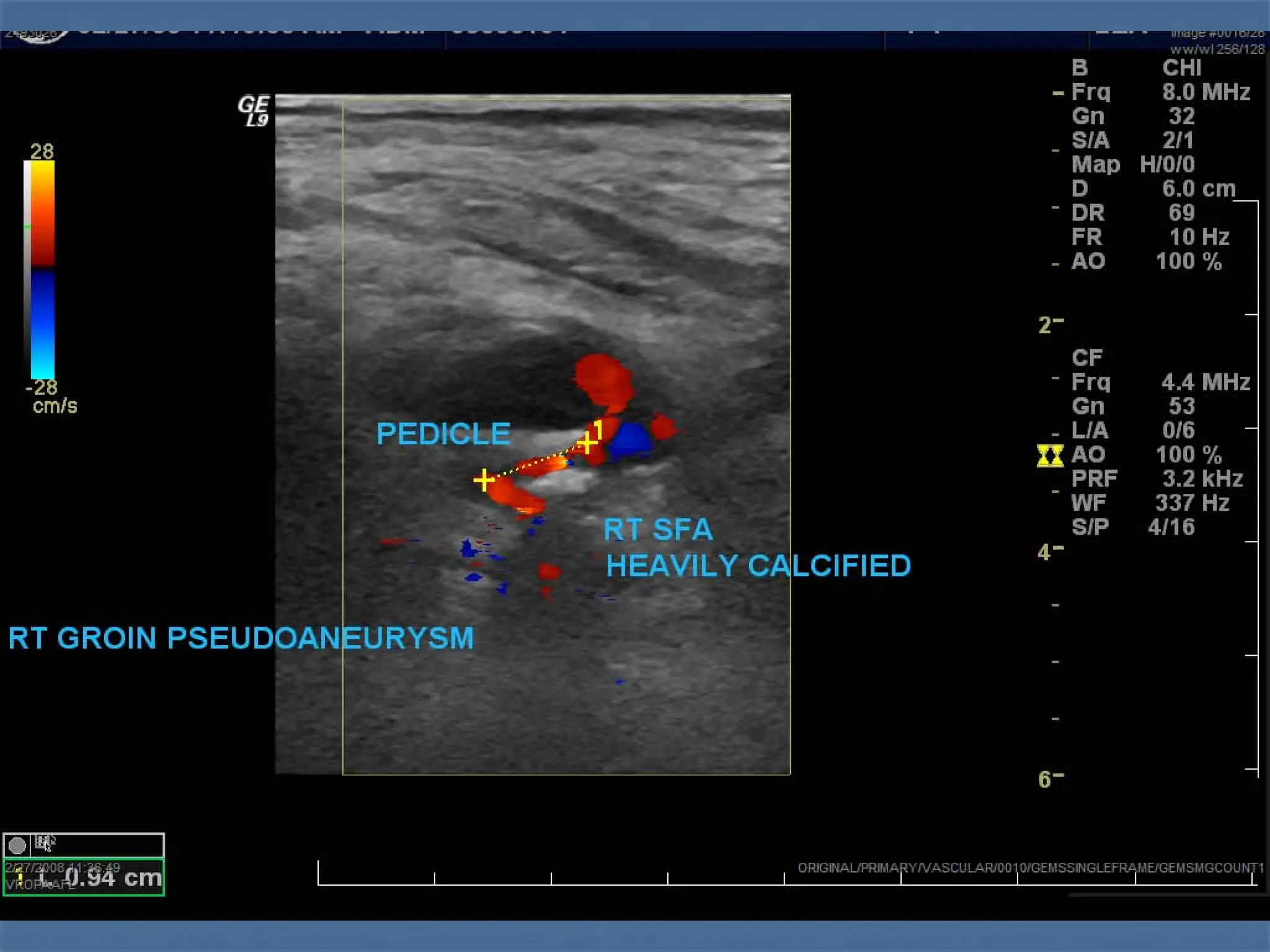 Cardiac Cath Lab Basics ( PDFDrive ).pdf