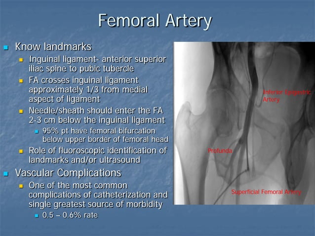 Cardiac Cath Lab Basics ( PDFDrive ).pdf