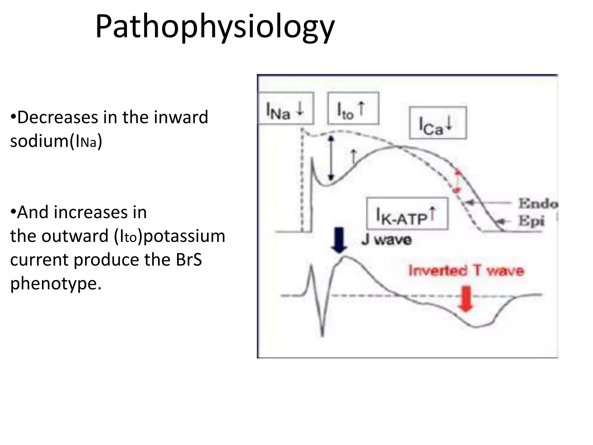 Cardiac Channelopathies atul.pptx