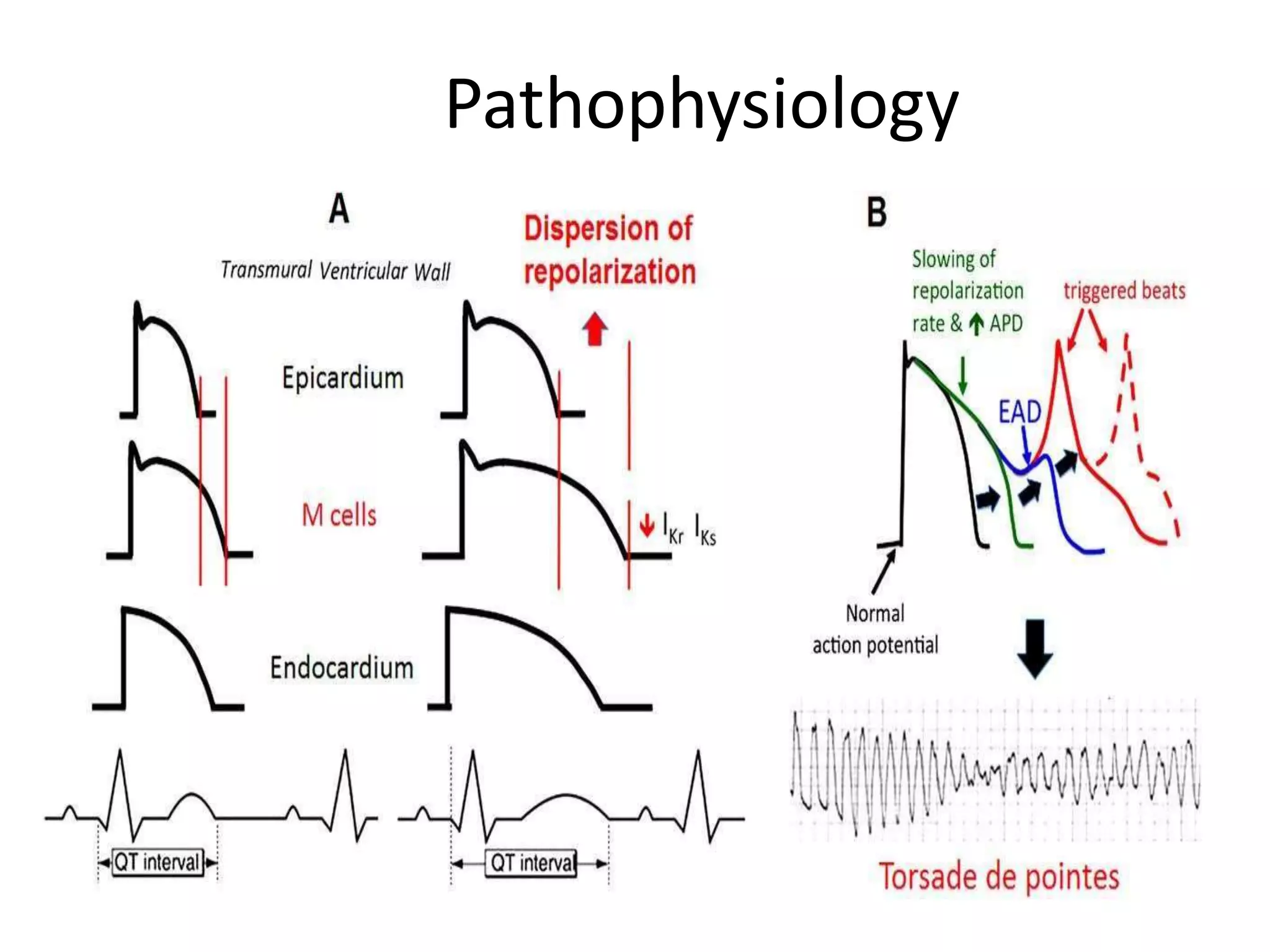 Cardiac Channelopathies atul.pptx