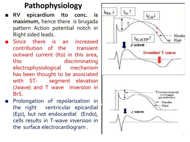 Cardiac Channelopathies atul.pptx