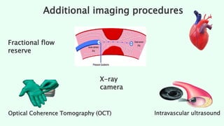cardiac chathitarazation1.pptx........... | PPTX
