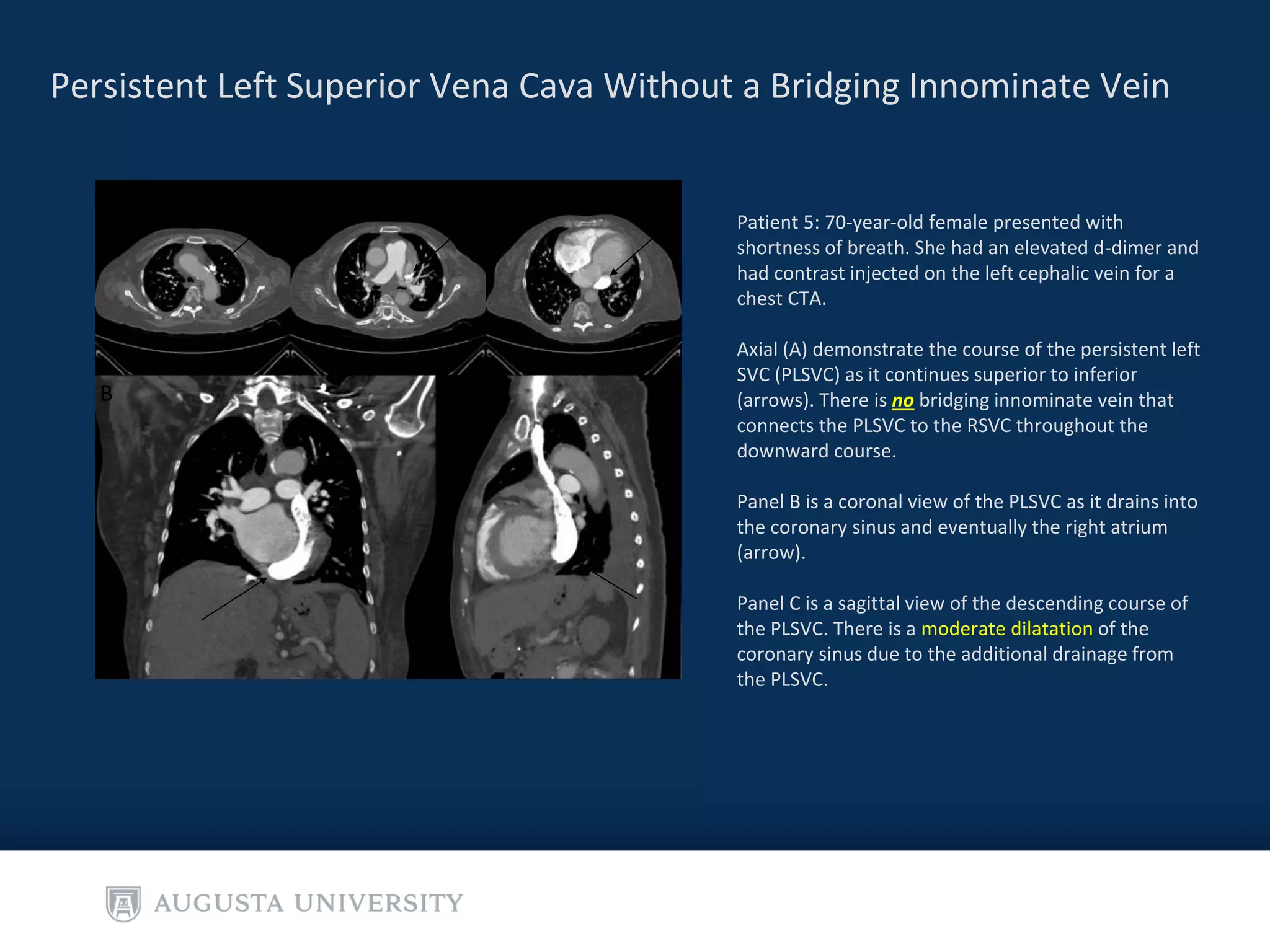 Cardiac radiology conference march 2017 | PPTX