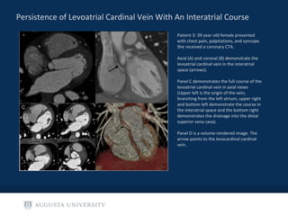 Cardiac radiology conference march 2017 | PPT