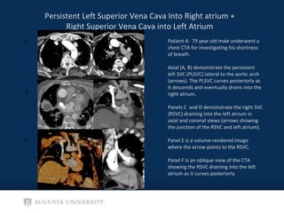 Cardiac radiology conference march 2017 | PPT