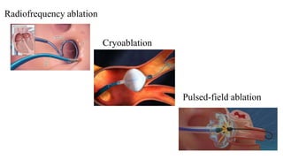 Cardiac Cryoablation.pptx
