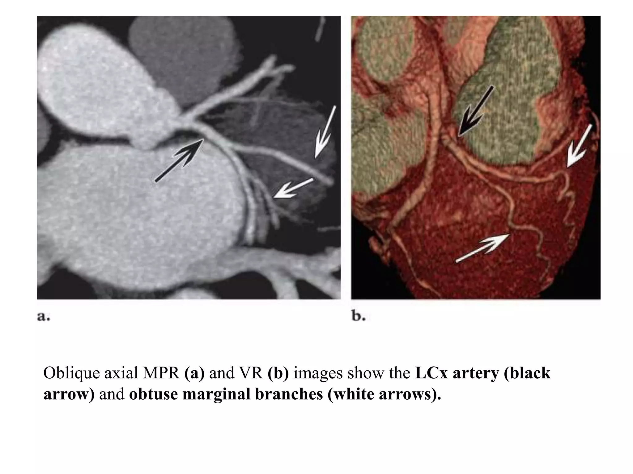 Cardiac CT | PPTX