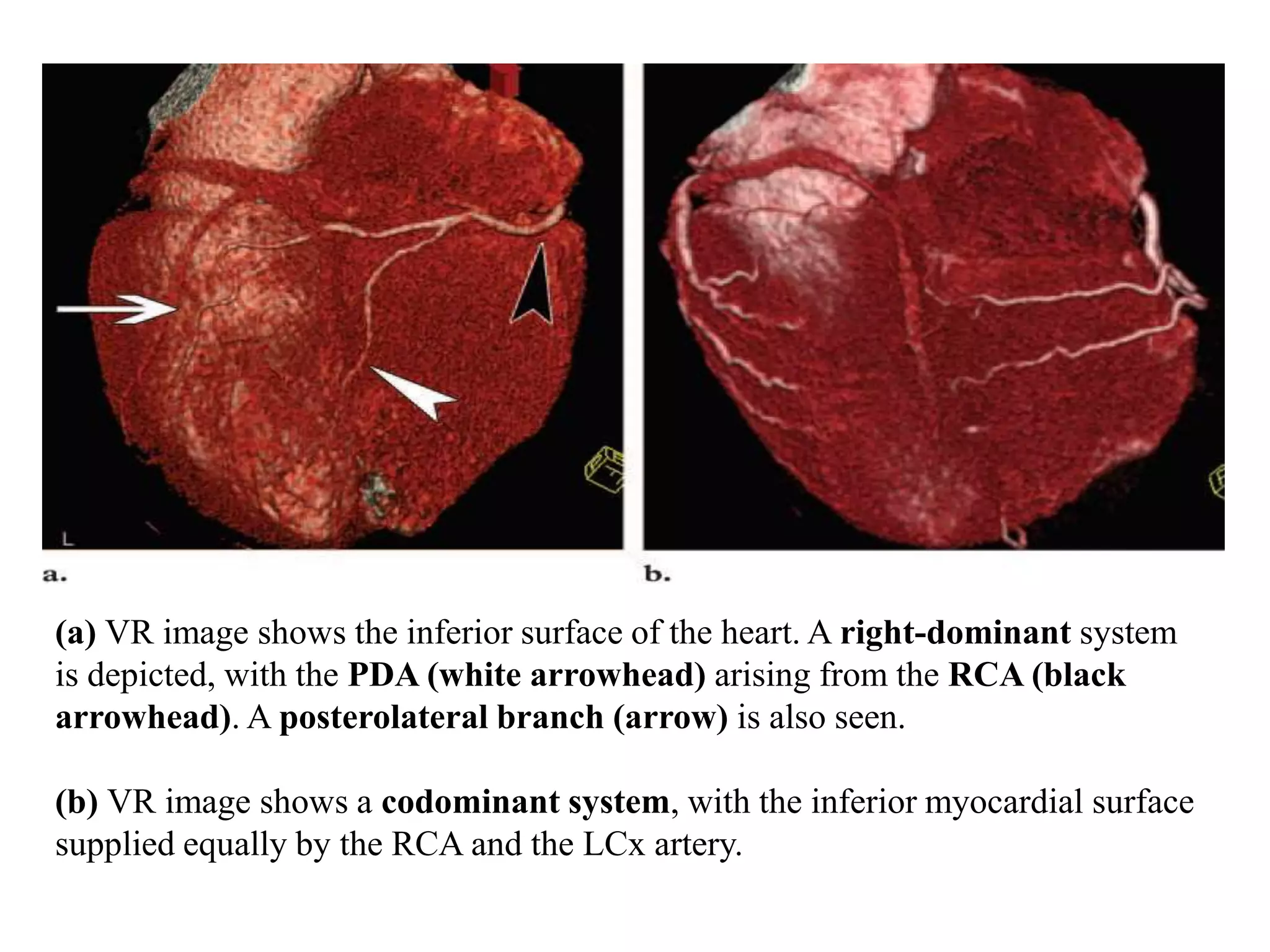 Cardiac CT | PPTX