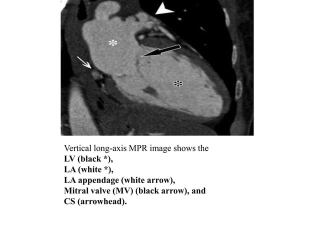 Cardiac CT | PPT