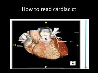 PEDIATRIC Cardiac ct | PPTX
