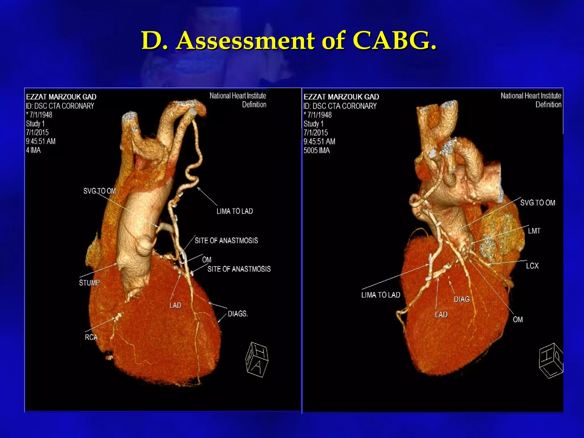 Cardiac ct ccta | PPT