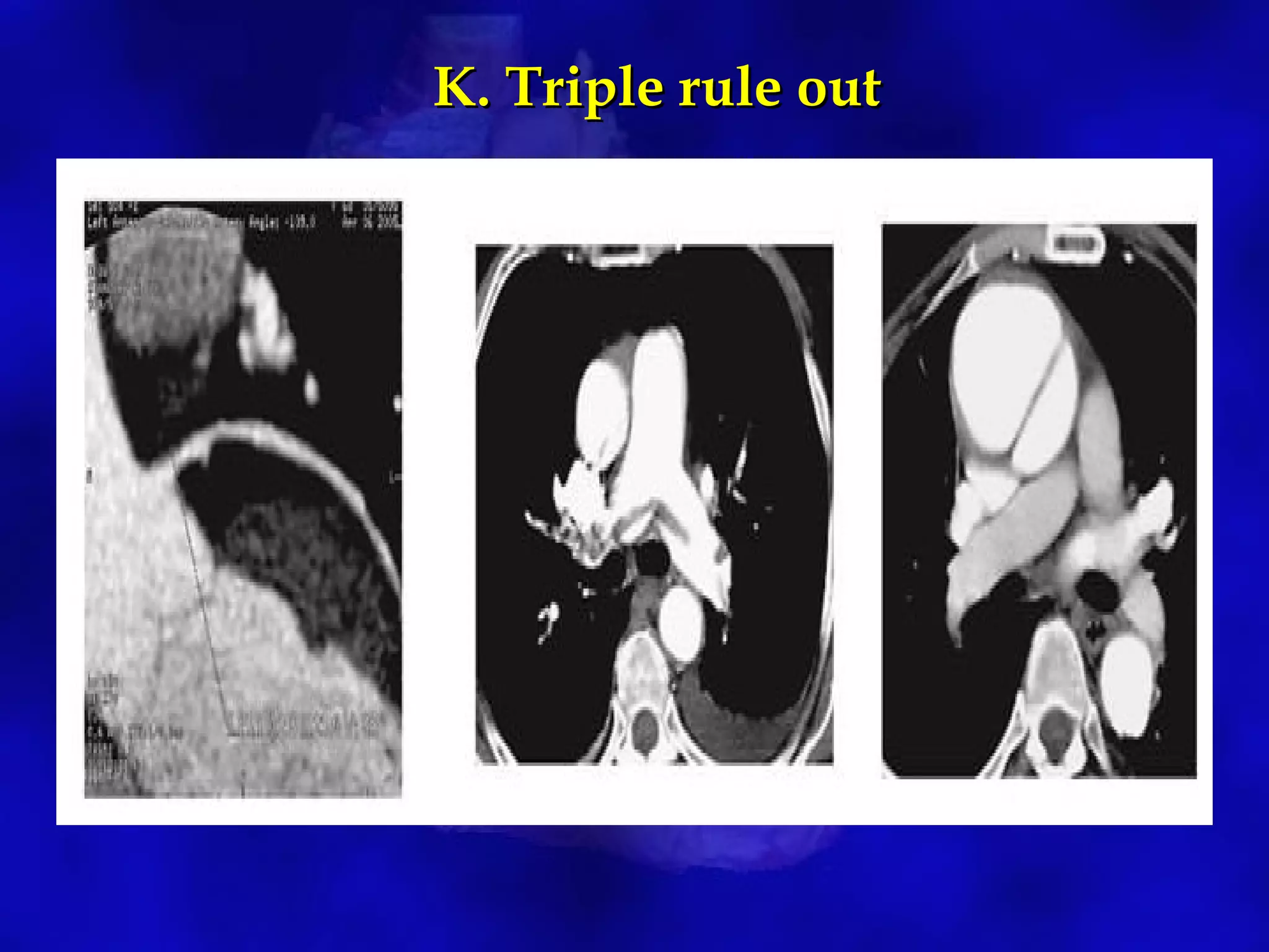 Cardiac ct ccta | PPT | Heart and Cardiovascular Diseases | Diseases ...
