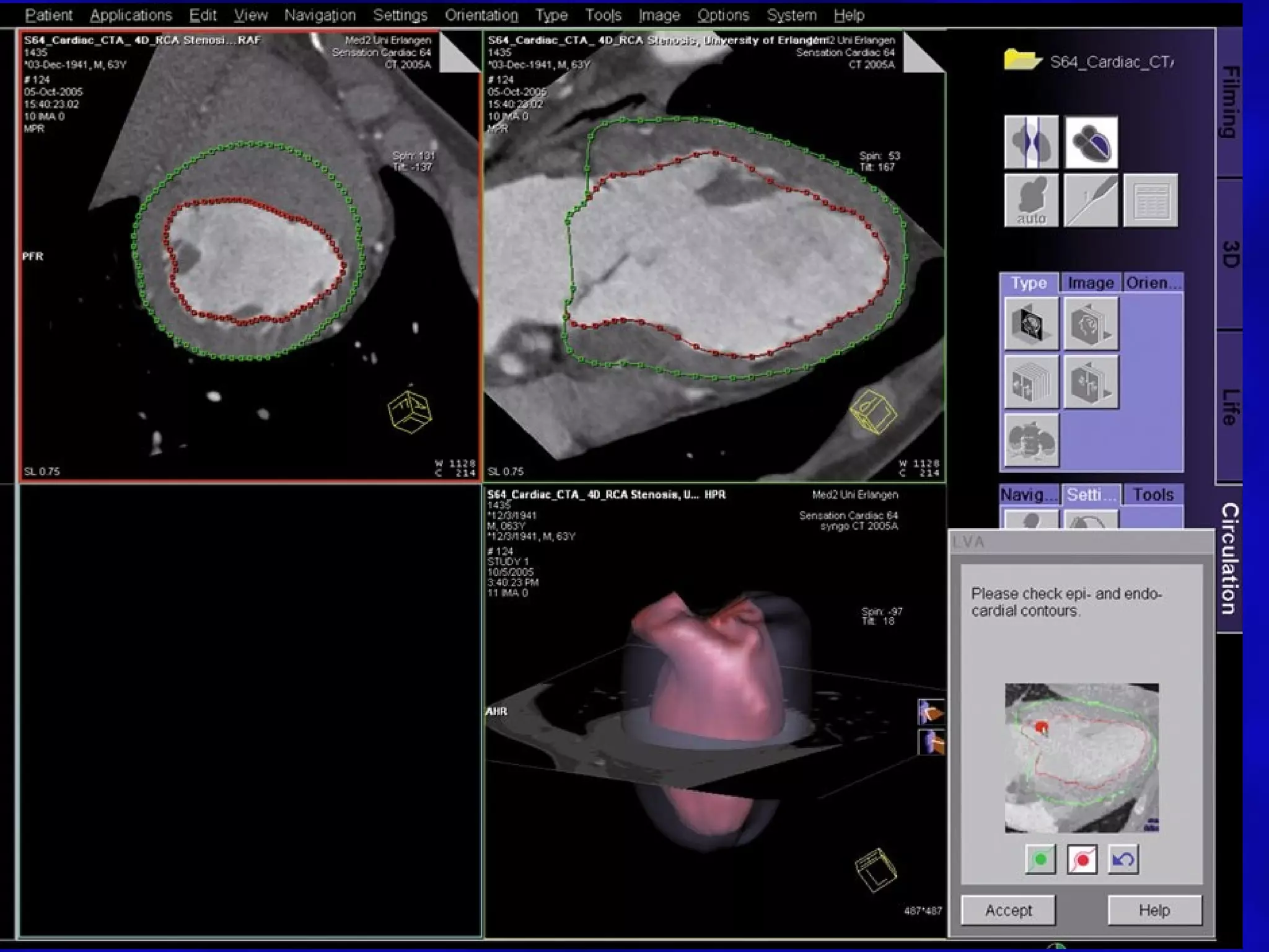 Cardiac ct ccta | PPT