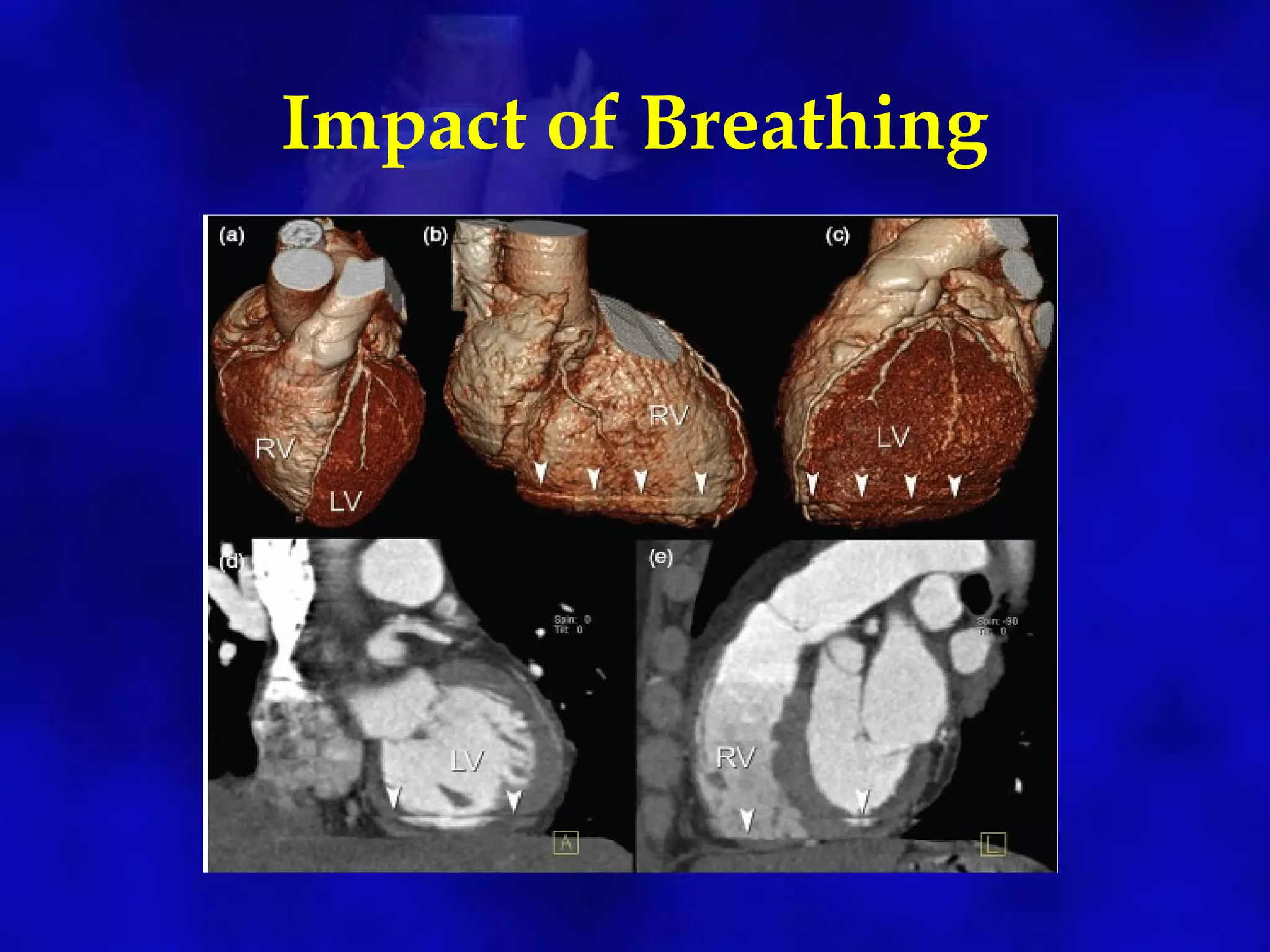 Cardiac ct ccta | PPT