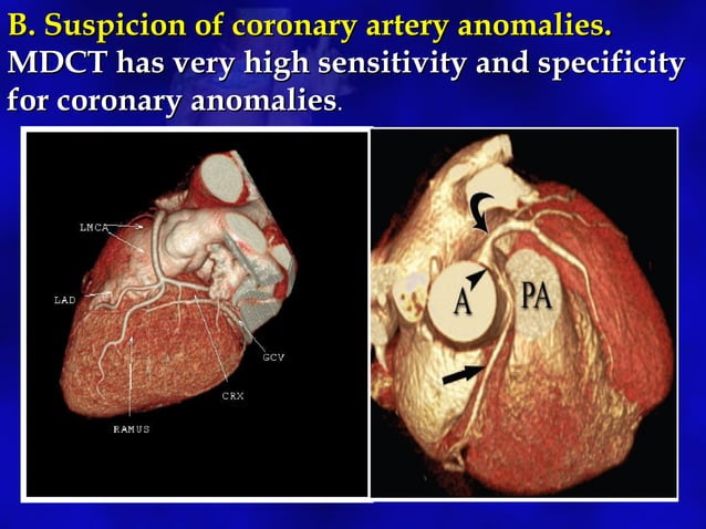 Cardiac ct ccta | PPT | Heart and Cardiovascular Diseases | Diseases ...