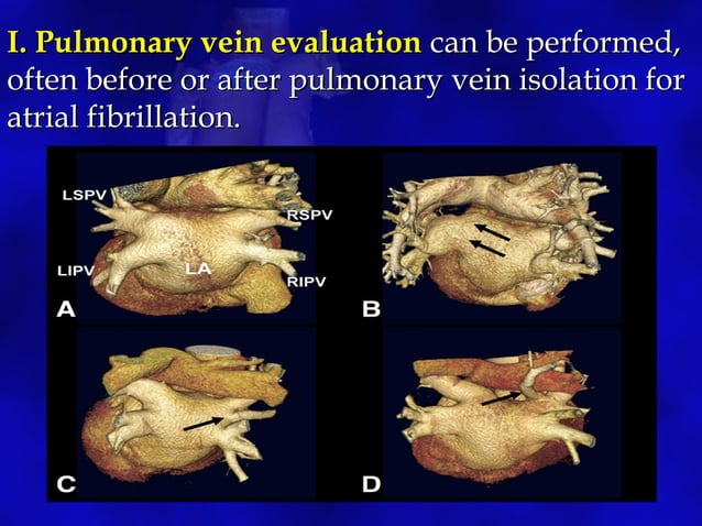 Cardiac ct ccta | PPT | Heart and Cardiovascular Diseases | Diseases ...