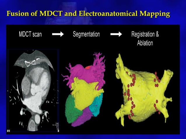 Cardiac ct ccta | PPT | Heart and Cardiovascular Diseases | Diseases ...