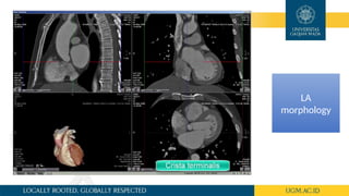 CARDIAC CT ANATOMY Book Reading Rahmat Muliawan | PPTX