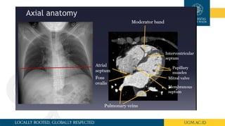CARDIAC CT ANATOMY Book Reading Rahmat Muliawan | PPTX